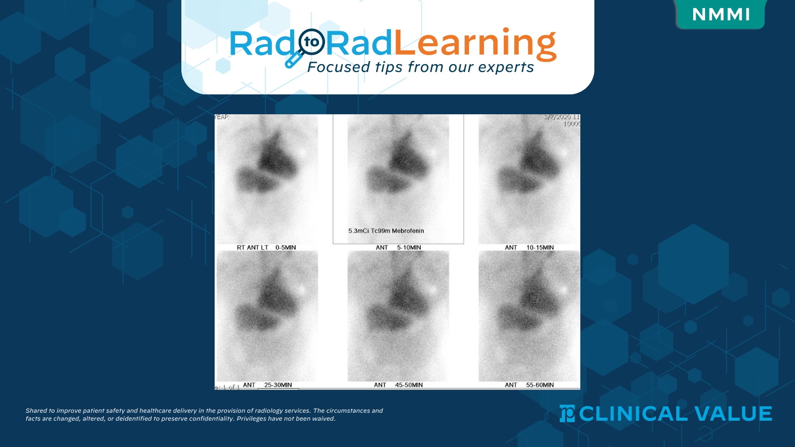Rad to Rad Learning: HIDA - Nonexcreting Liver