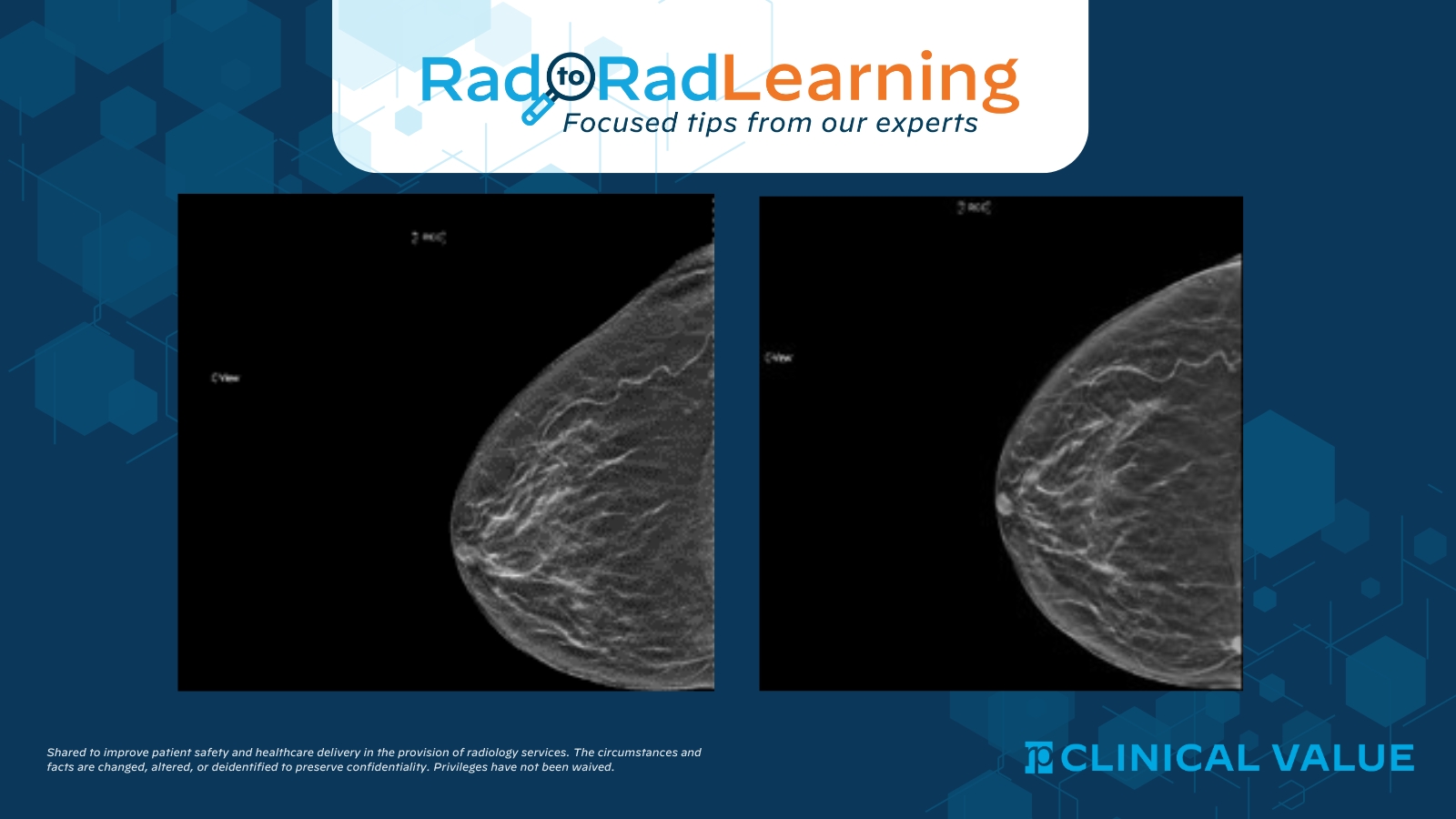 Rad to Rad Learning: Technique Matters