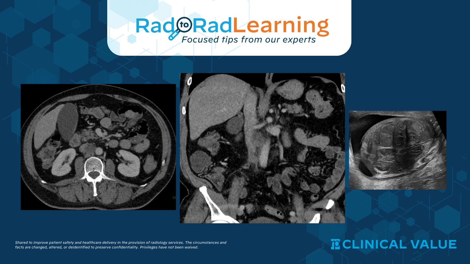 Rad to Rad Learning: Abdominal Lymphadenopathy
