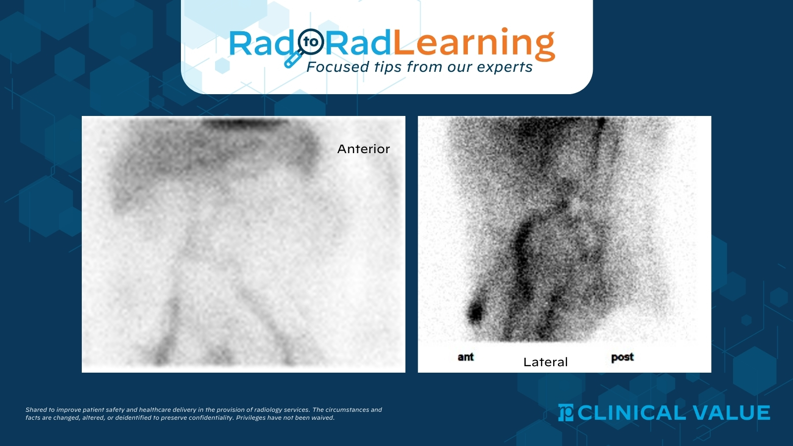 Rad to Rad Learning: False Positive GI Bleed