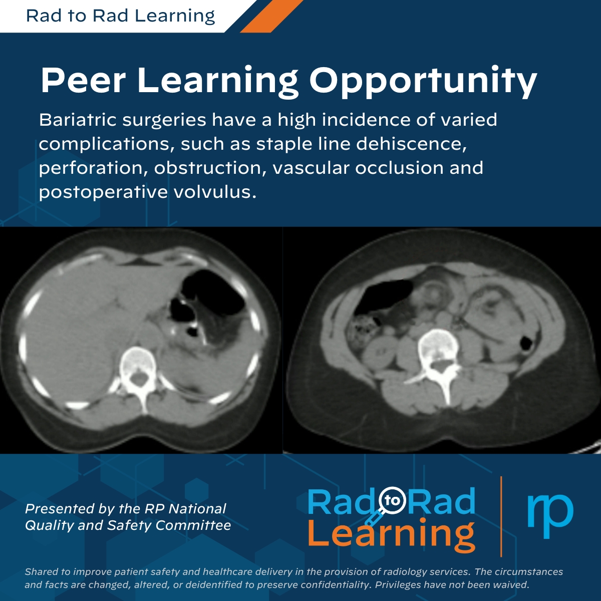Rad to Rad Learning: Post-Bariatric Surgery Complications