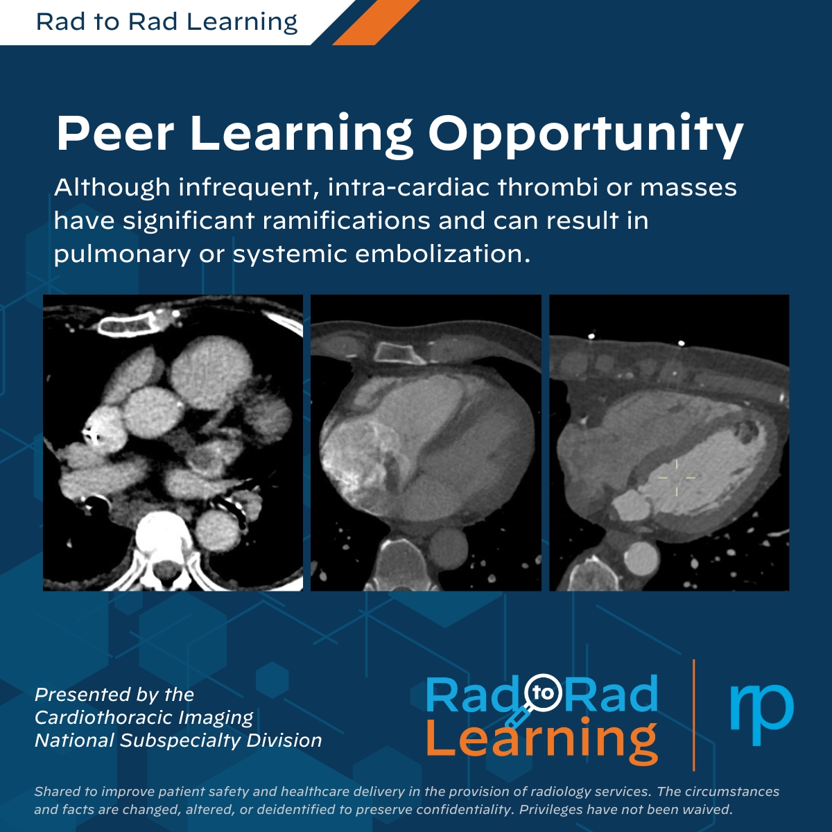 Rad to Rad Learning: Incidental Intra-Cardiac Lesions