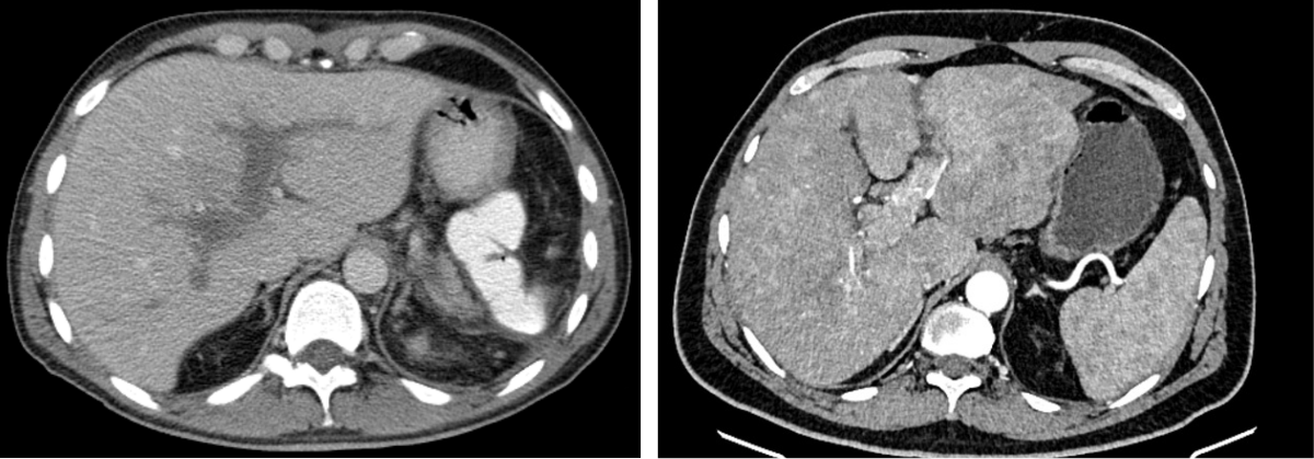 Search Results for: 2025 - Radiology Partners